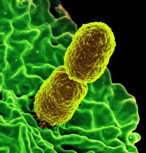 WHO offers list of most deadly pathogens - The Durango Herald