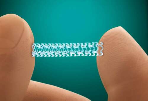 FDA OKs 1st dissolving stent for patients - The Durango Herald